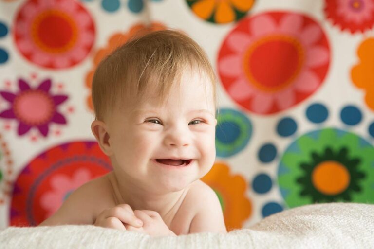 What is Down Syndrome: Types, Signs & Causes - Leaf Complex Care